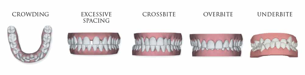 Orthodontics Melbourne - Core Dental