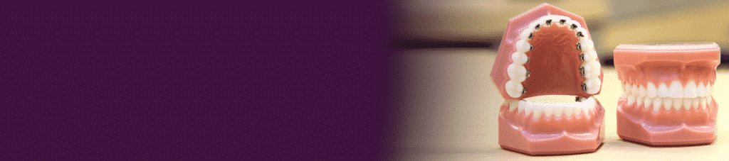 Internal Lingual Braces Melbourne | Orthodontics | Smile Solutions